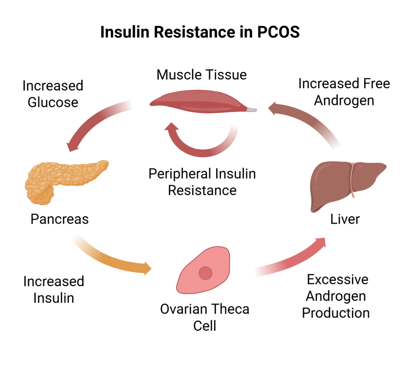 Insulin Resistance in Polycystic Ovary Syndrome and its Impact on Women ...