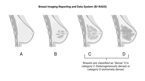 Meta-Analysis: Improving Breast Cancer Detection By Screening For ...